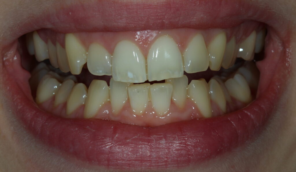 Περιστατικά – Β. Καρατζογιάννη